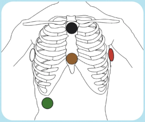 Telemetry ECG: Revolutionizing Continuous Cardiac Monitoring in ...